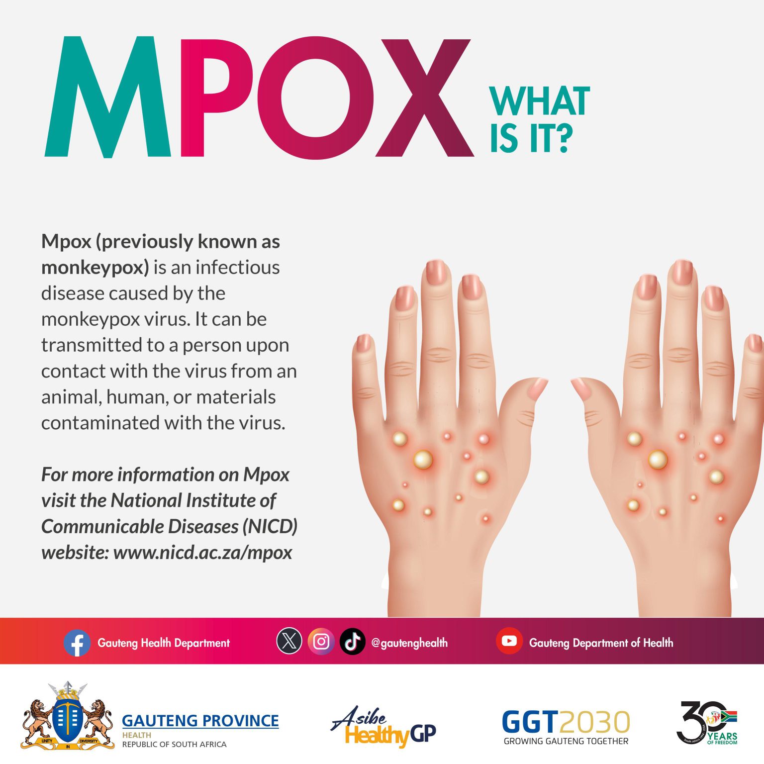 Outbreaks – Mpox – National Department of Health