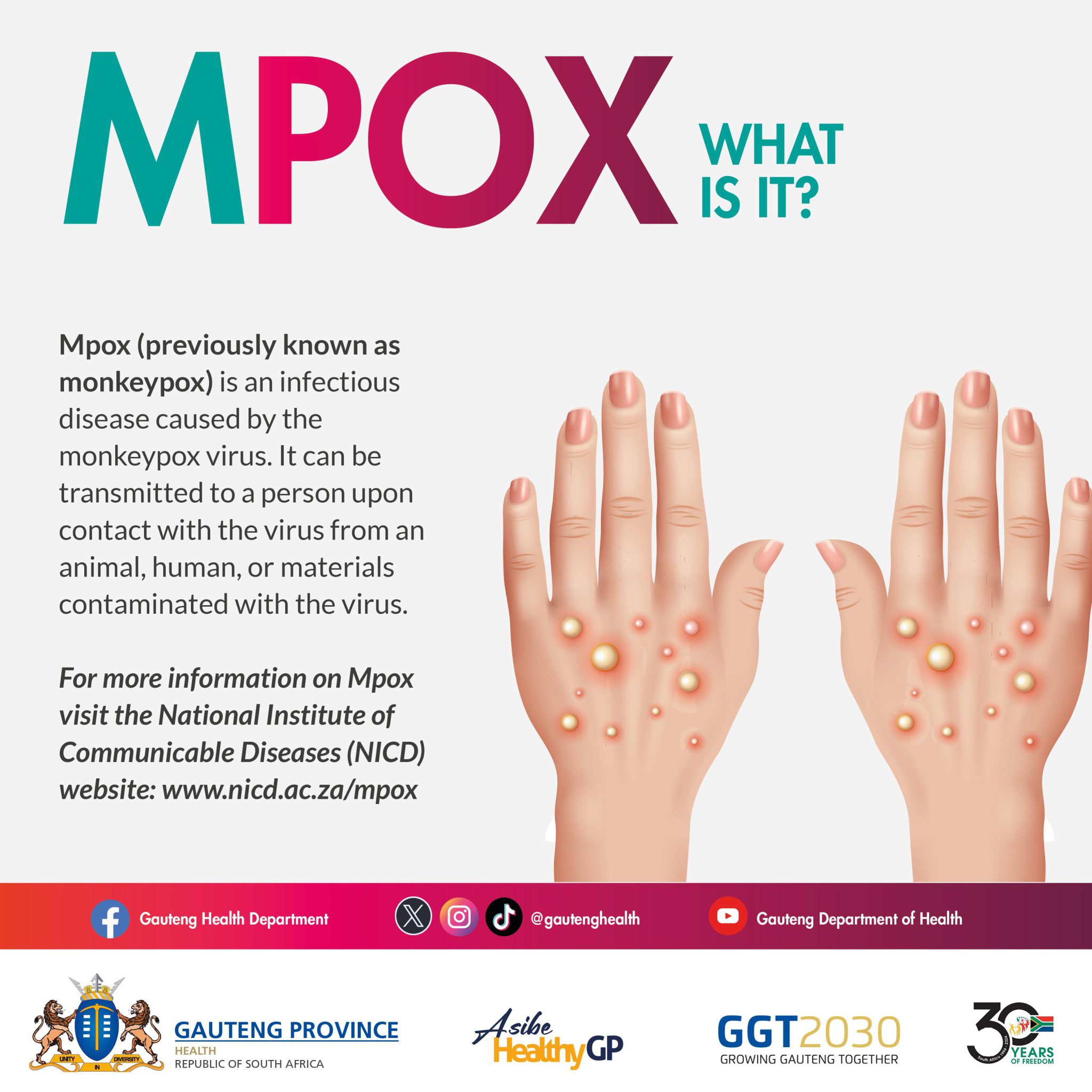 Outbreaks – Mpox – National Department of Health