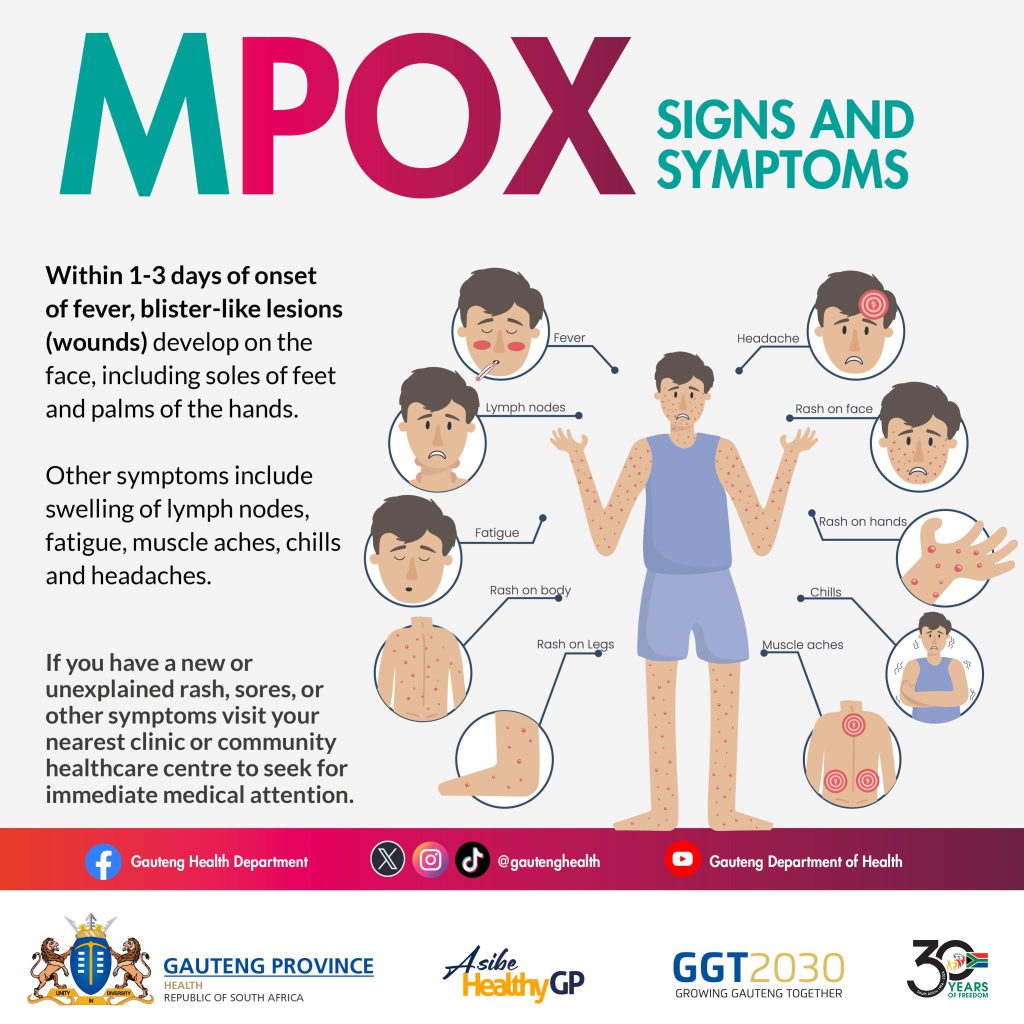 Outbreaks – Mpox – National Department of Health