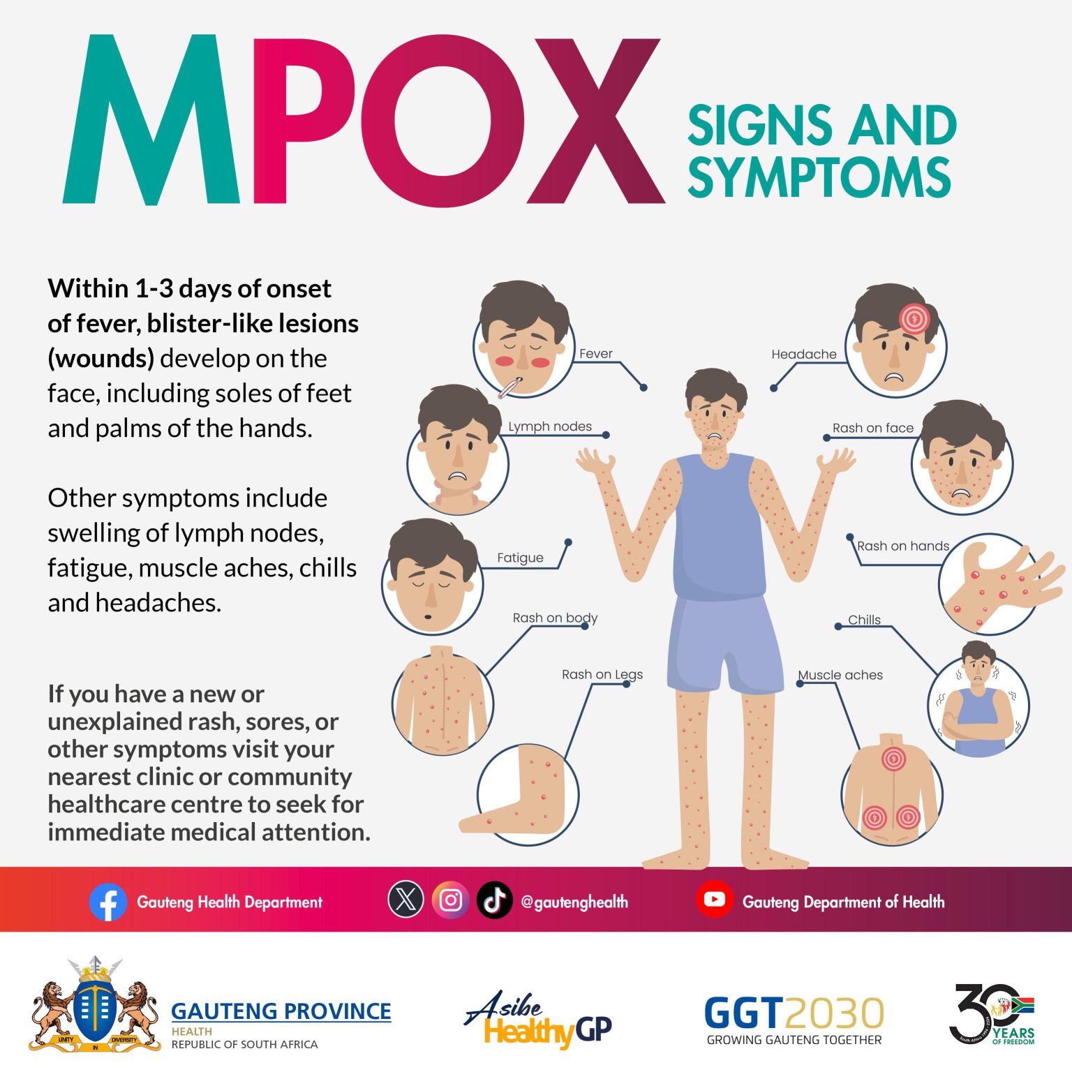 Outbreaks – Mpox – National Department of Health