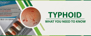 Outbreaks – Typhoid – National Department of Health